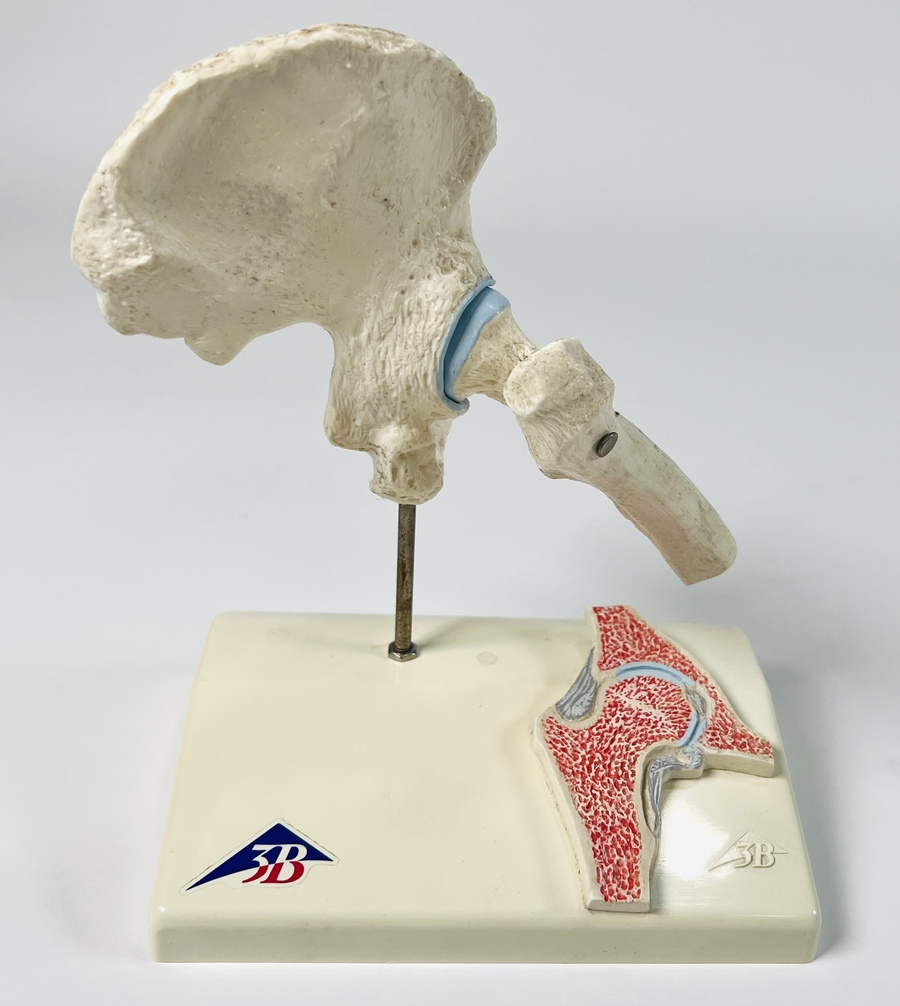 Model heupgewricht - auctions & price archive