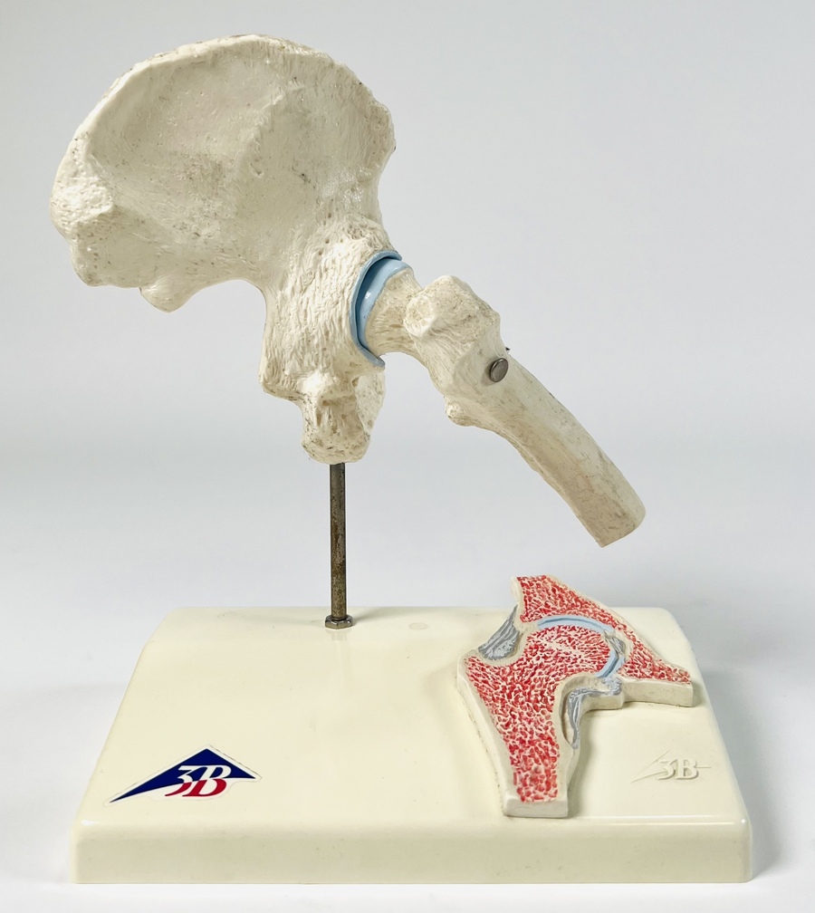 Model heupgewricht - auctions & price archive